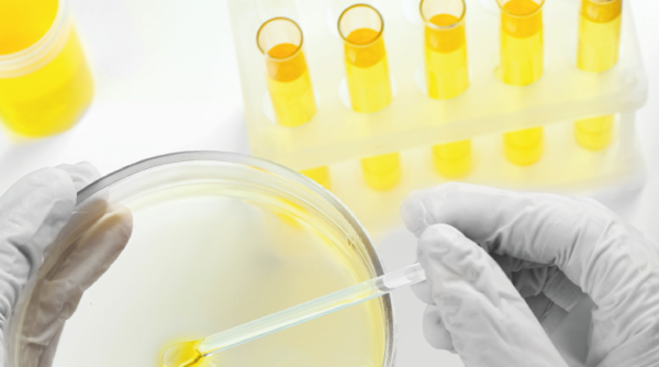 La place de l’examen cytobactériologique des urines (ECBU) en chirurgie